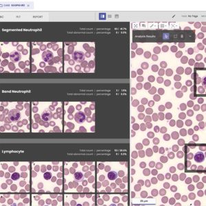 Full-Field Peripheral Blood Smear Application | Scopio Labs
