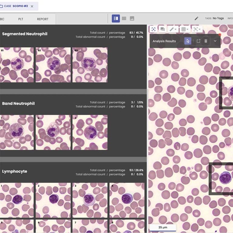 Full-Field Peripheral Blood Smear Application | Scopio Labs